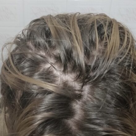 Dit gebeurt er met je haar als je het één week niet wast!